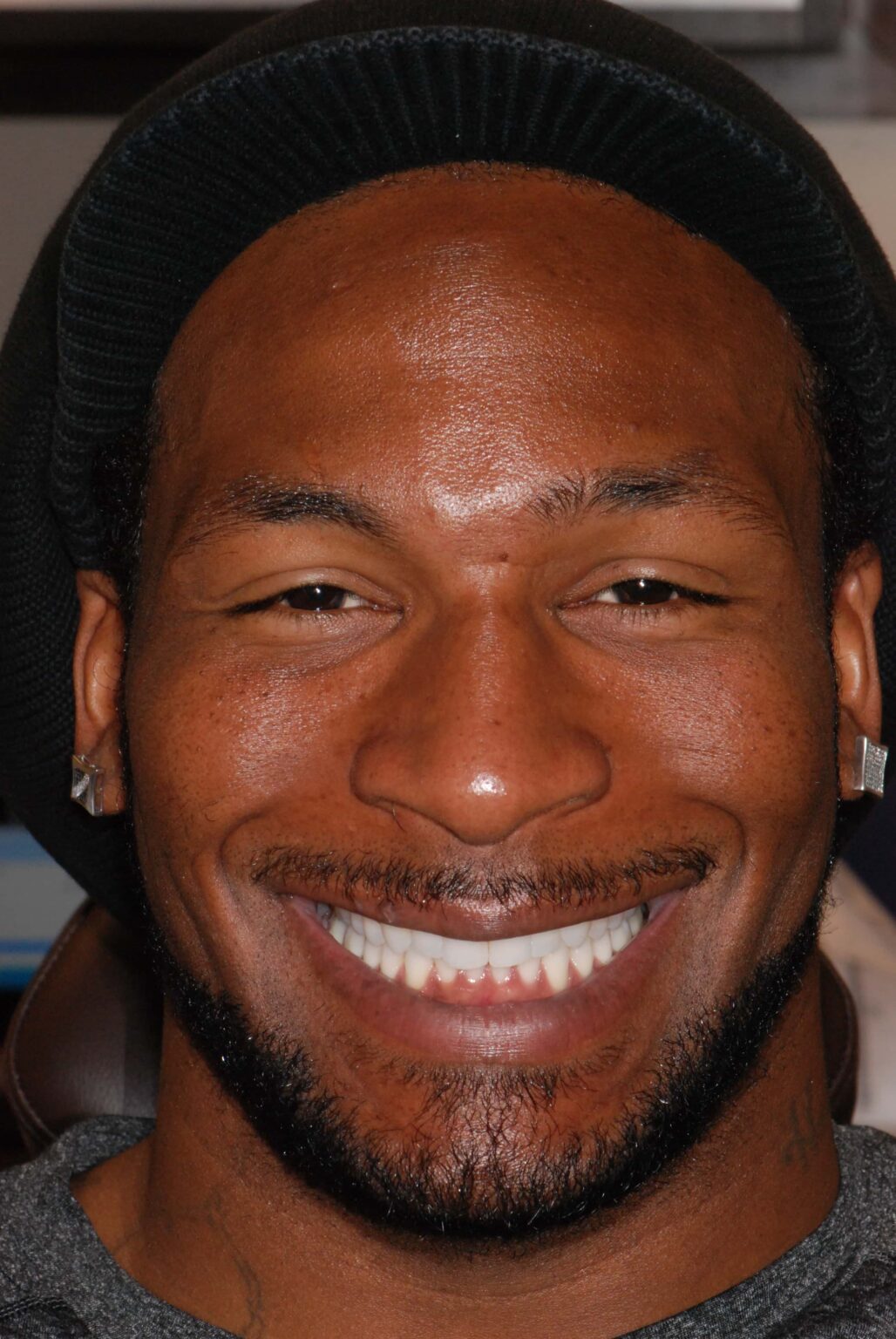 Bradburn Village Dentistry | Dentist | Wellness Coaching | Westminster, CO